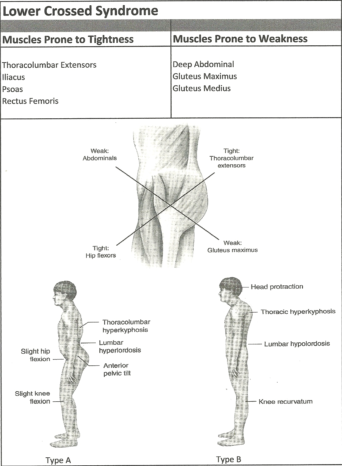 Janda’s Classification of Muscle Imbalance Patterns | castlebodywork