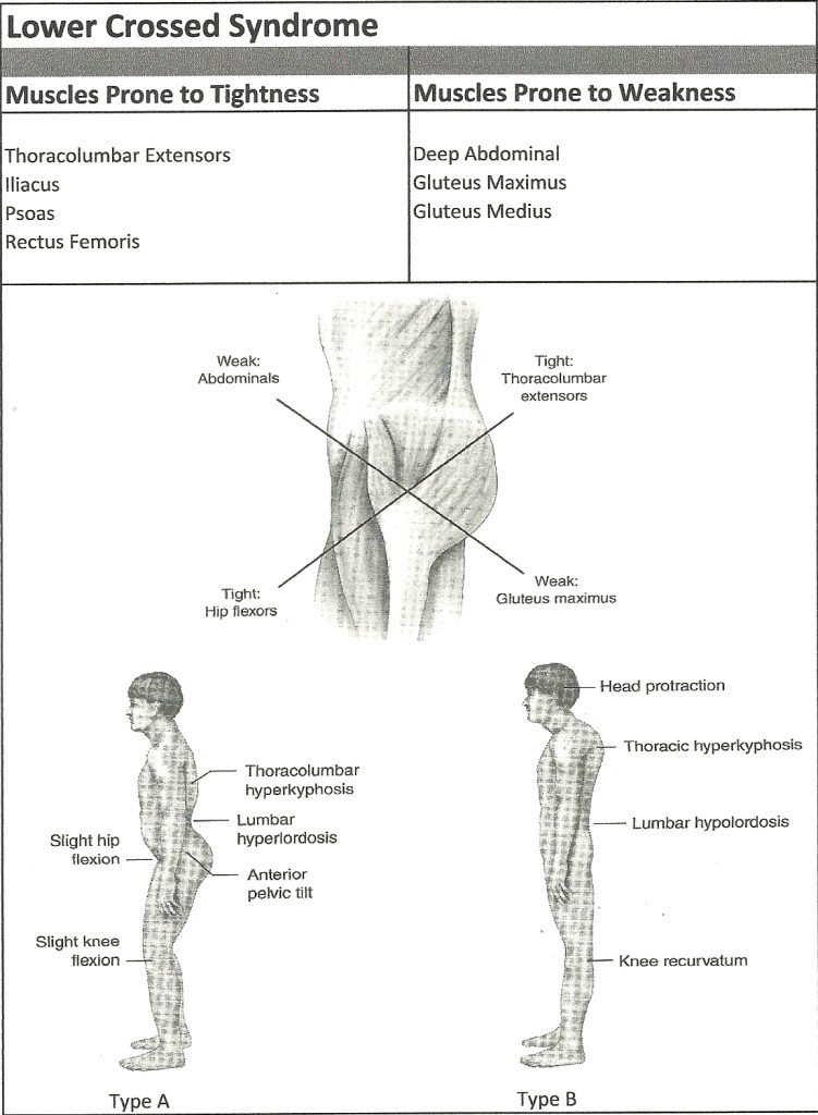 Janda’s Classification of Muscle Imbalance Patterns | castlebodywork