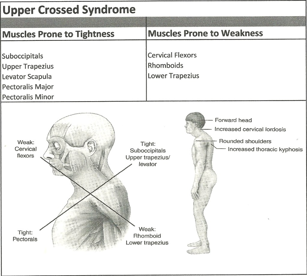 Janda’s Classification of Muscle Imbalance | castlebodywork